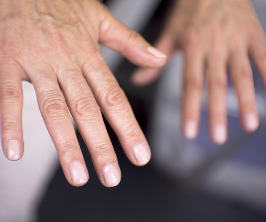 La polyarthrite rhumatoïde conseils santé & recommandations diététiques ...